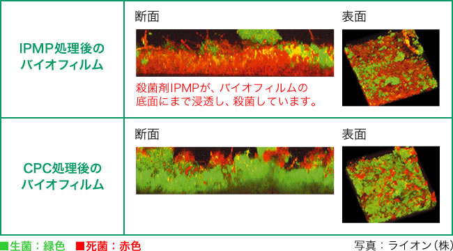 Systema 薬用歯間ジェル ｜ DENT. | ライオン歯科材株式会社