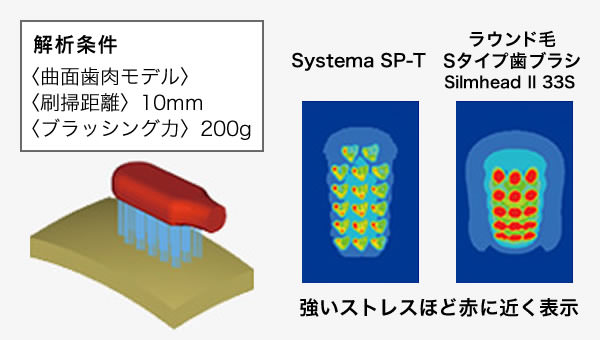 Systema SP-T歯ブラシ ｜ DENT. | ライオン歯科材株式会社