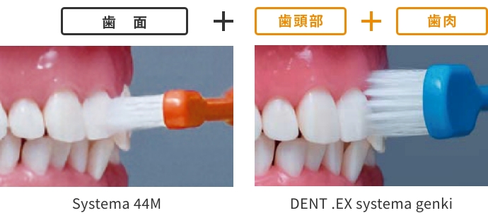 DENT.EX systema genki ｜ DENT. | ライオン歯科材株式会社